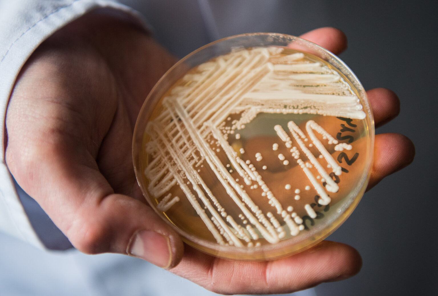 Hefen - Schimmelpilzportal