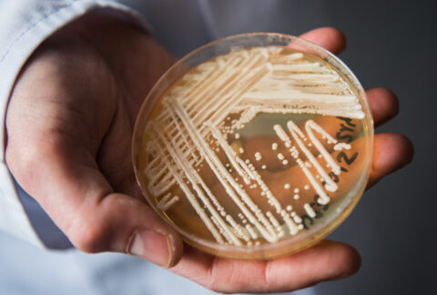 Hefen - Schimmelpilzportal